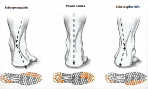 Cómo saber que tipo de pisada tienes - Iván Fisioterapia Zaragoza
